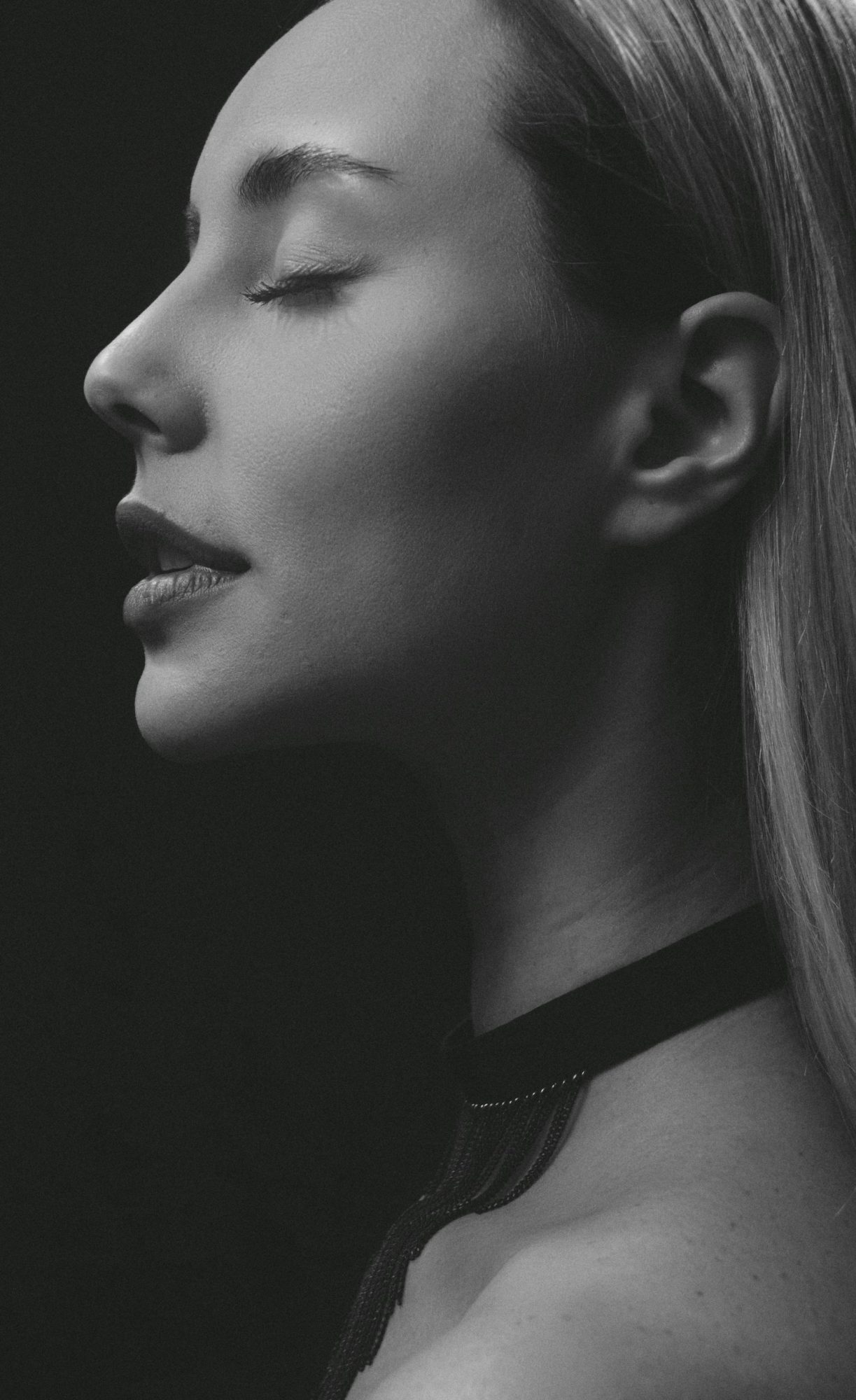 Microlifting facial • Dr. Joaquín Lora